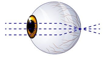 Myopia Management | Clearview Family Eyecare